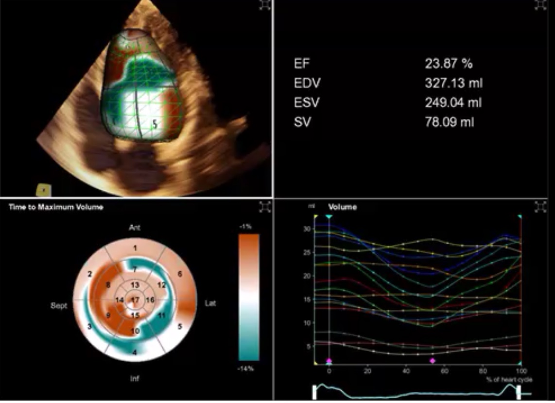 Recent Advances in Cardiovascular Imaging – Part I - TheSynapse